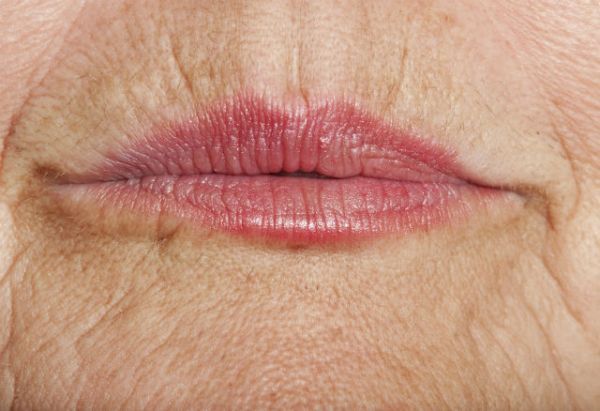 4 Ways to Promote Wrinkles and How to Reduce Them Naturally