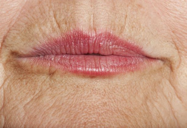 4 Ways to Promote Wrinkles and How to Reduce Them Naturally