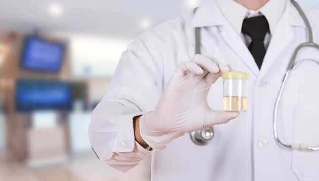 Why You Should Smell Your Pee - Can Actually Tell You A Lot