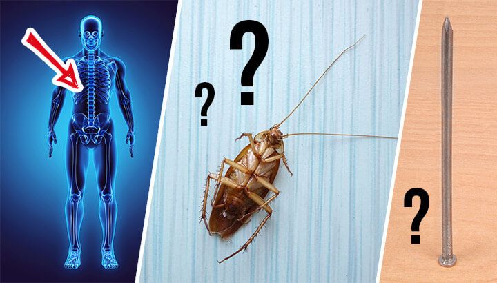 5 Weird Things Doctors Have Found In People's Bodies