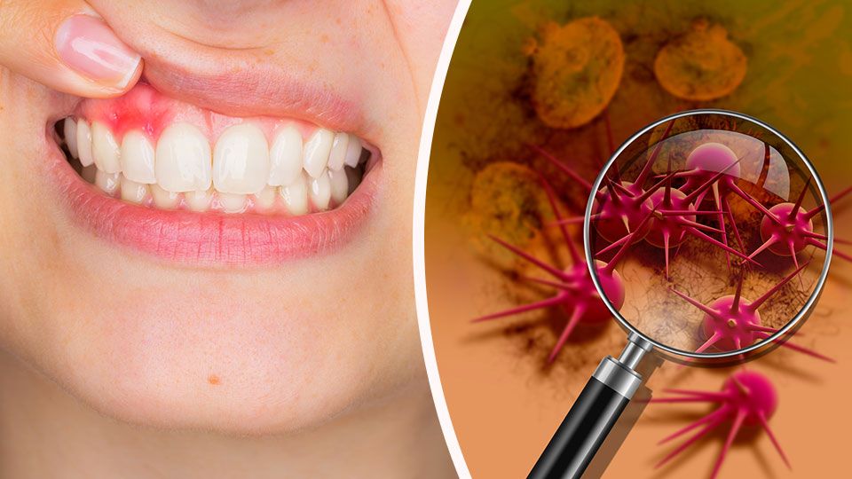 Here’s How To Know If You Have Inflammation In Your Mouth