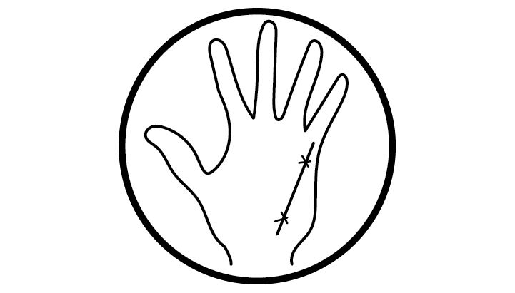 This Line On Your Palm Means Your Health Is Suffering