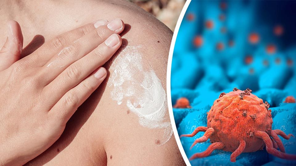 Is Your Sunscreen Increasing Your Risk Of Skin Cancer? Here’s Your ...
